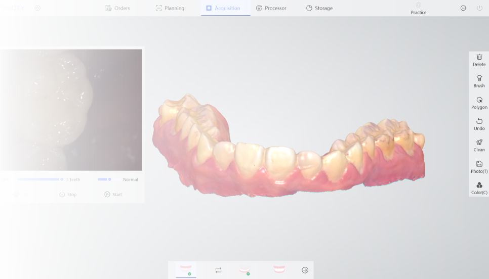 Panda P2 Intraoral Scanner | Digital Impressions for Dental Practice